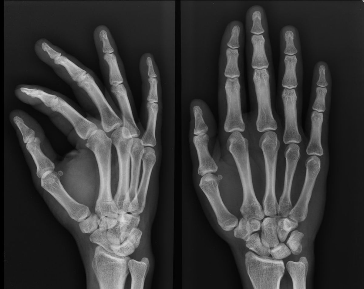 10 Things That Were Invented By Accident | The Odyssey Online