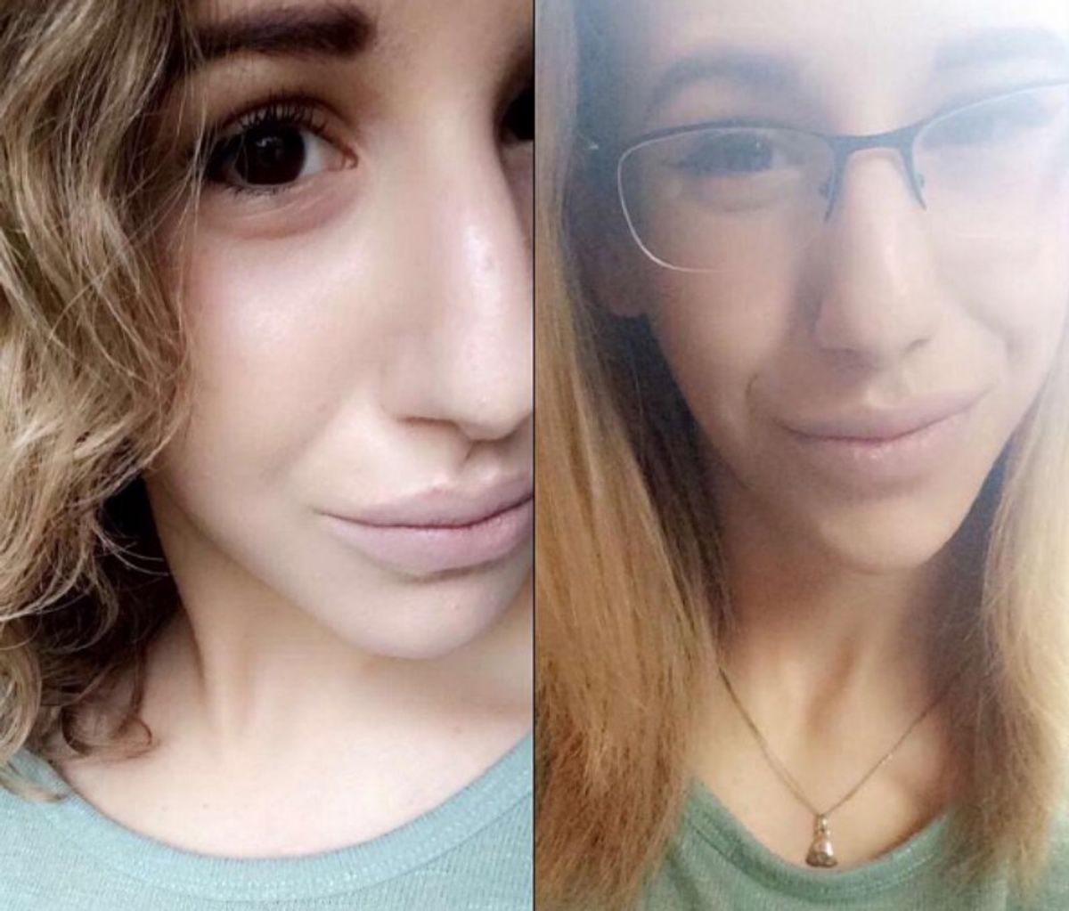 A Portrait Of Anorexia
