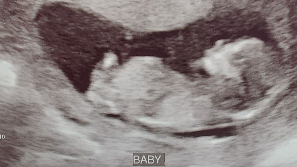 11 Promises To My Unborn Child | The Odyssey Online
