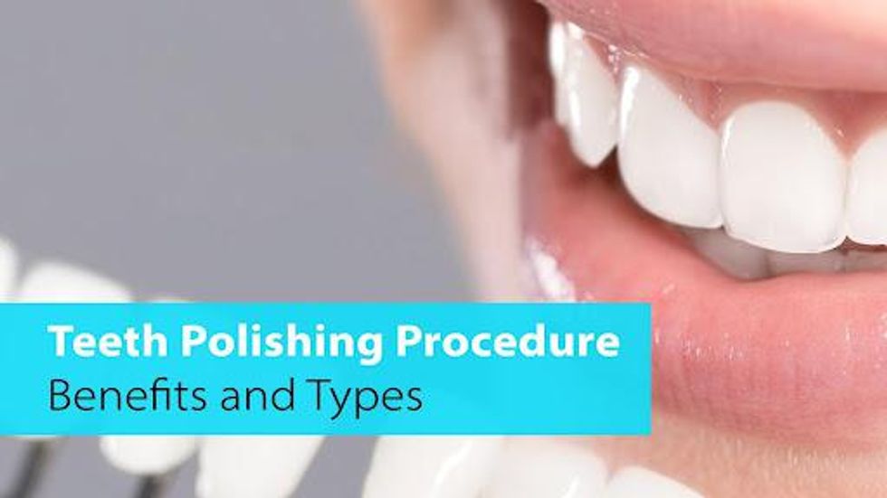 Teeth Polishing Procedure: Benefits and Types | The Odyssey Online