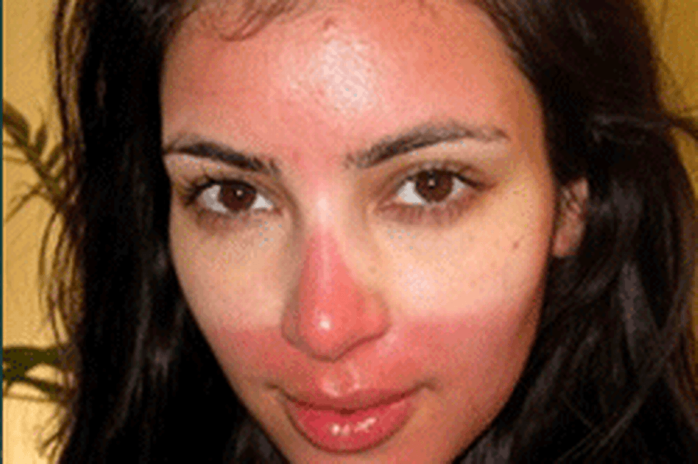 The 10 Stages Of A Sunburn | The Odyssey Online