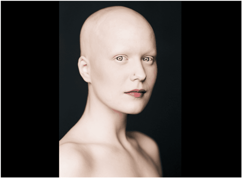 Bald Is Beautiful | The Odyssey Online